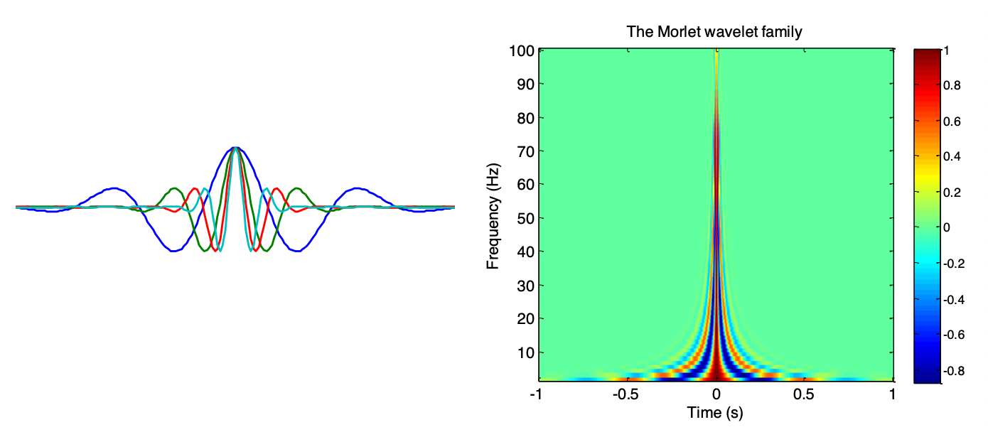 BME EEG Analysis Wavelet Transform Aursus BME EEG Analysis Wavelet Transform Aursus